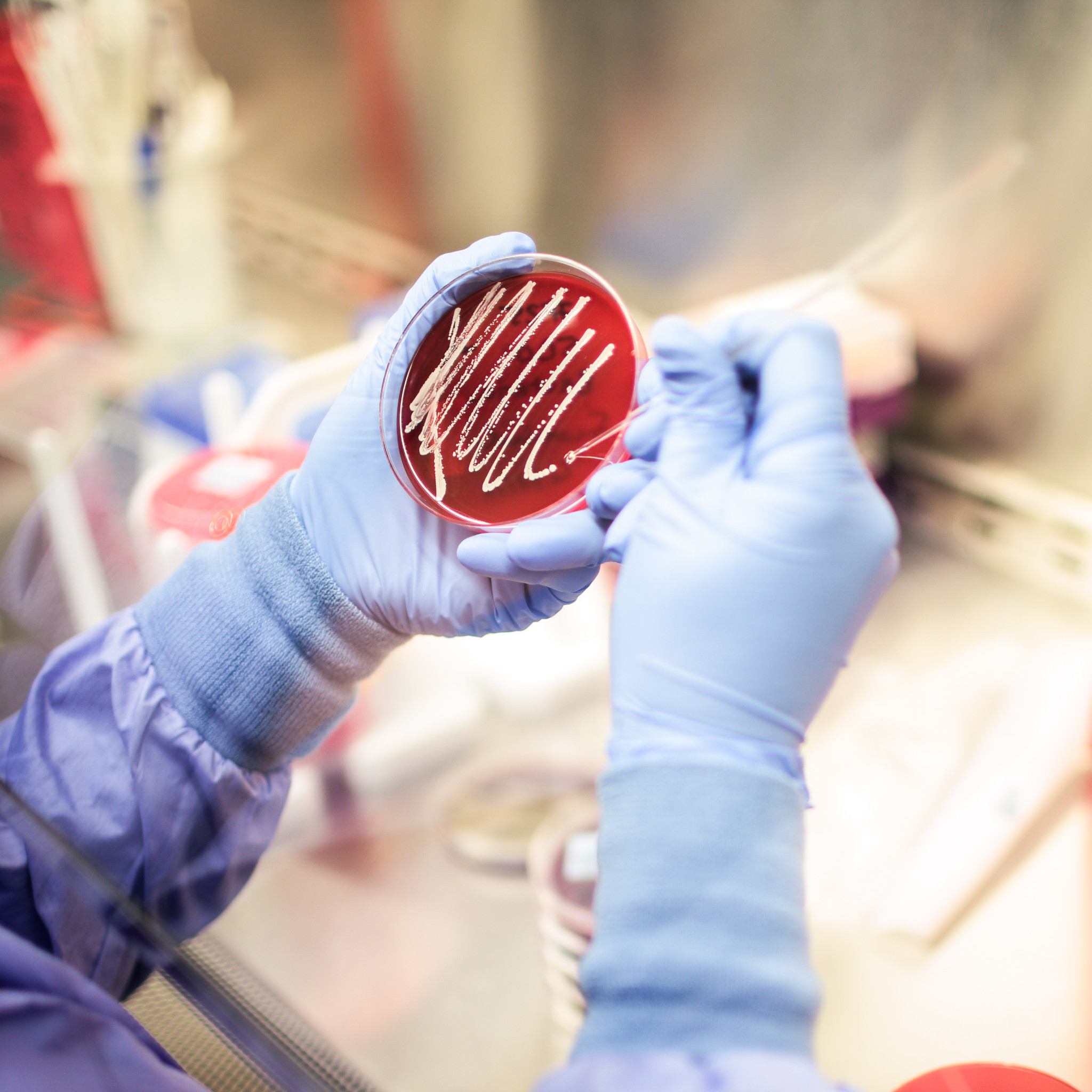 Microbial Identification and Sequencing – Let us show you what we can ...