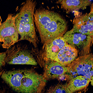 Cell Painting Assay | Charles River