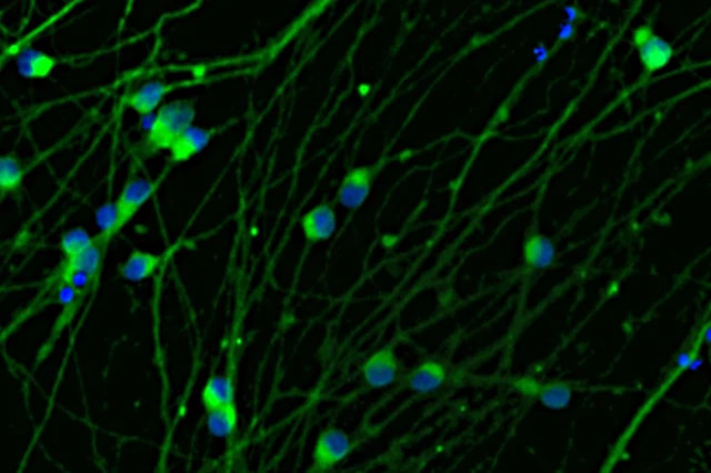 iPSC Reprogramming for Disease Cell Modeling | Charles River