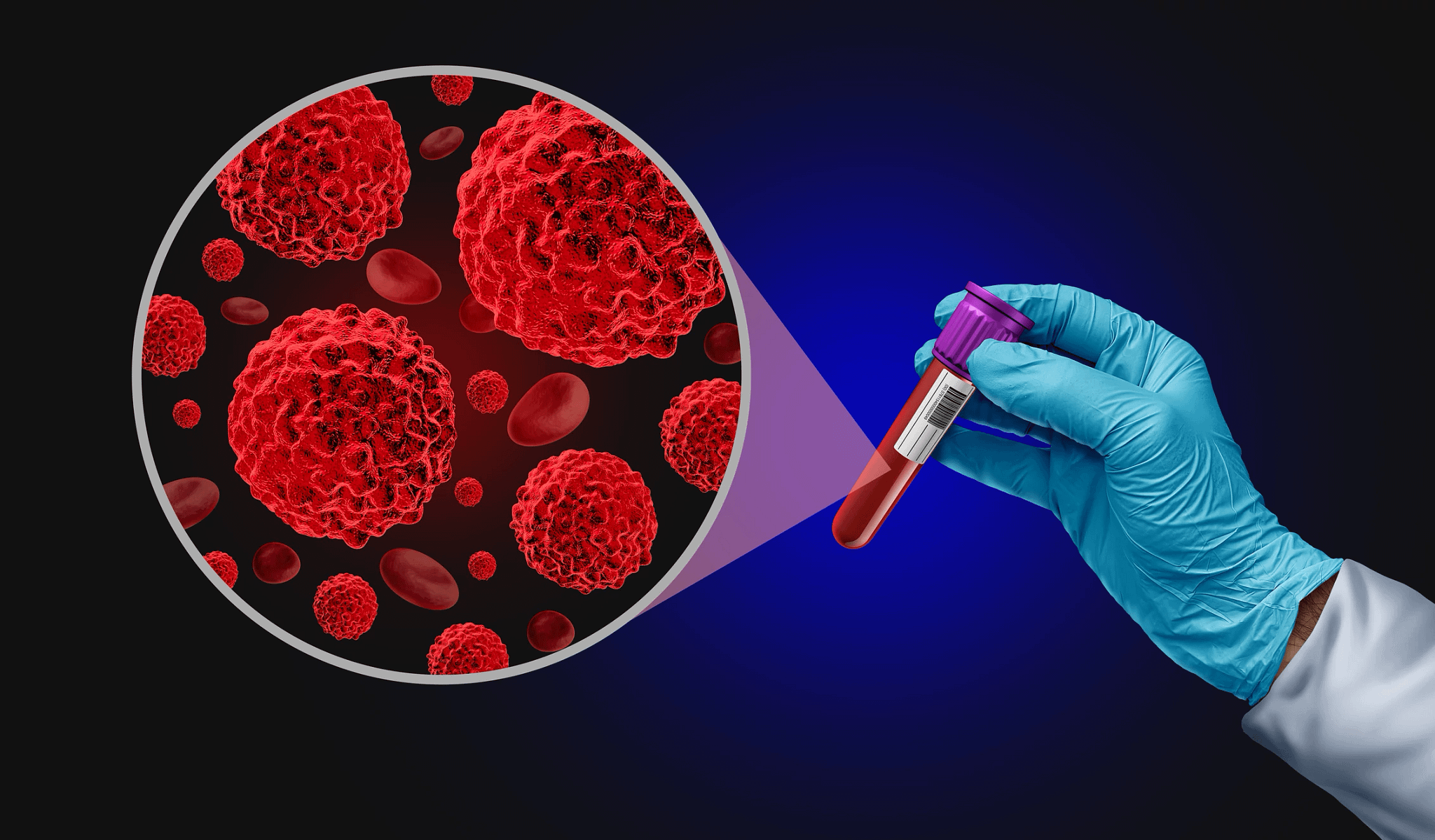 New Blood Test Can Detect Pancreatic Cancer Sooner | Eureka blog