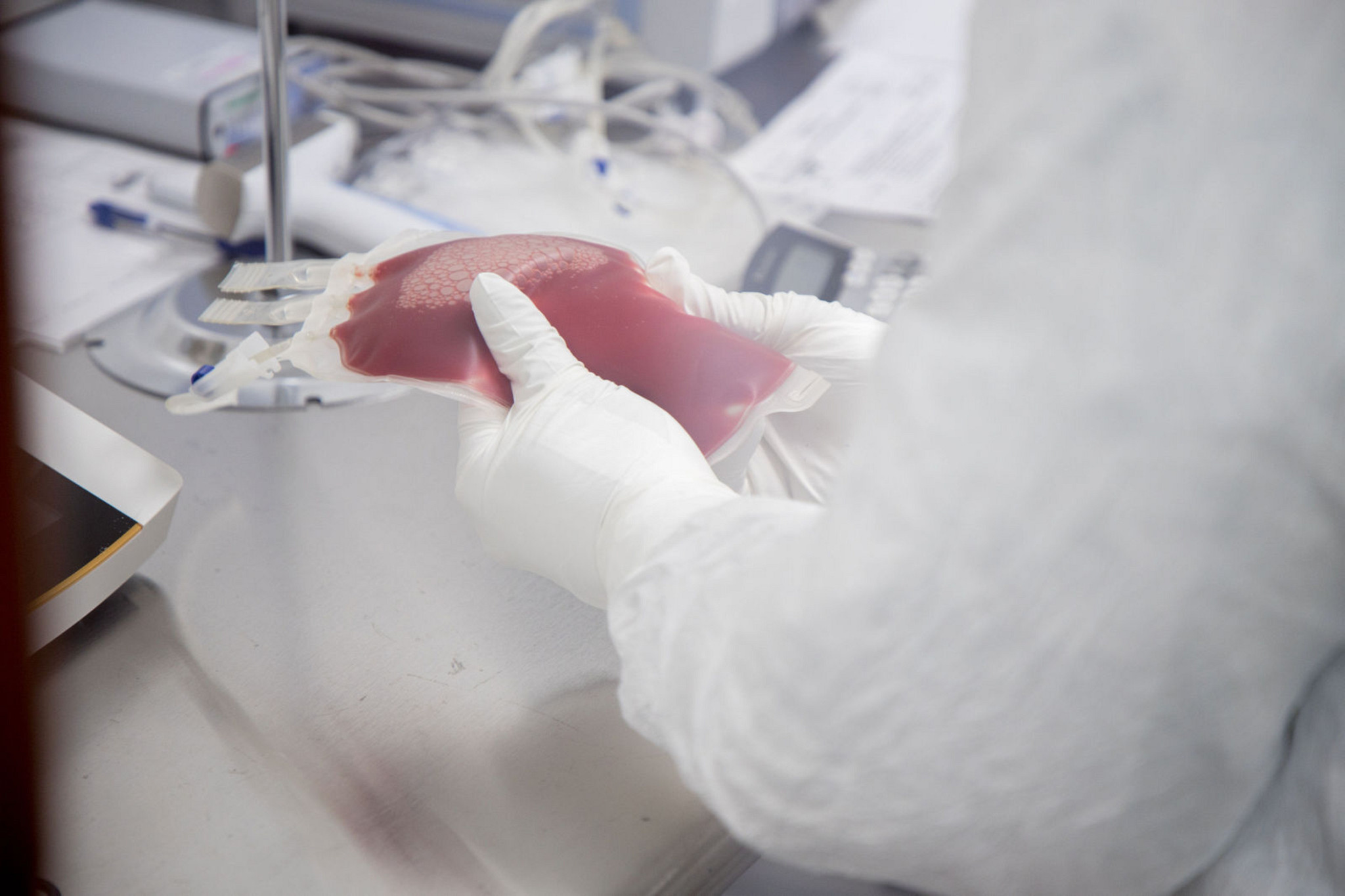 A Study Assessing Fresh Leukopak Stability | Charles River