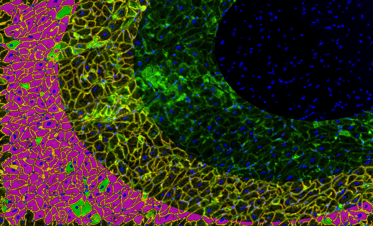 Stereology determining sampling precision - lasopacasa