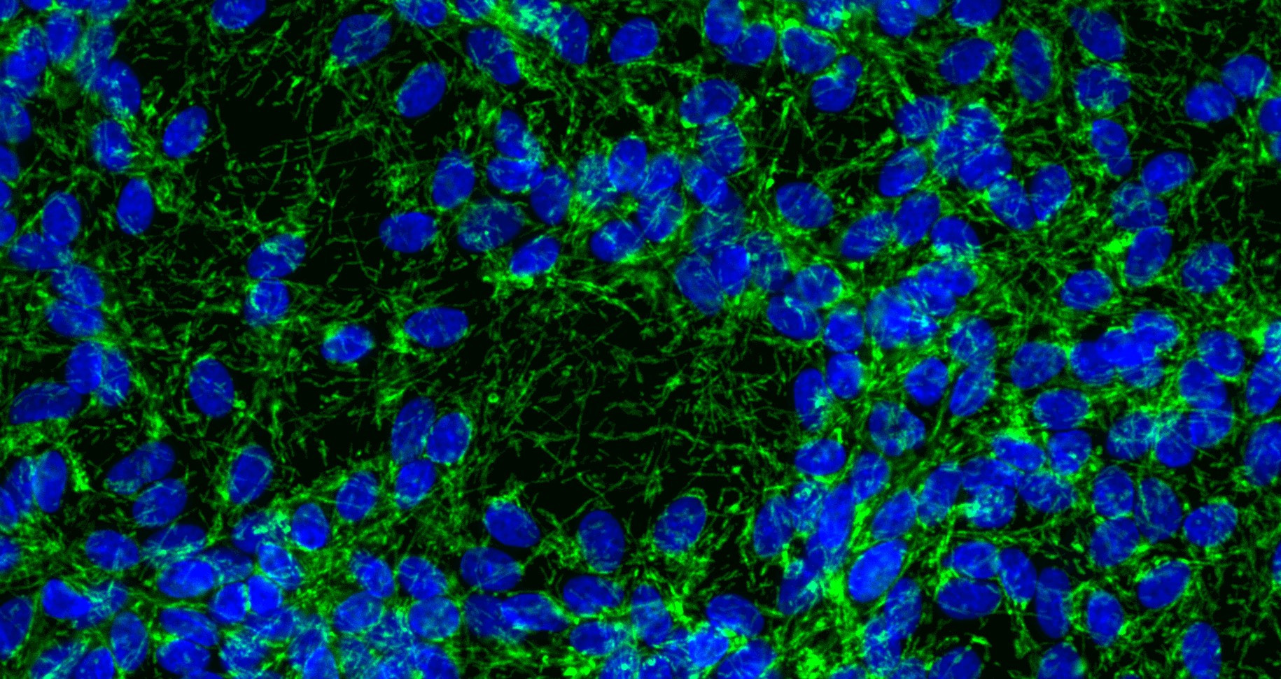 TOM20 Mitophagy Assay | Charles River