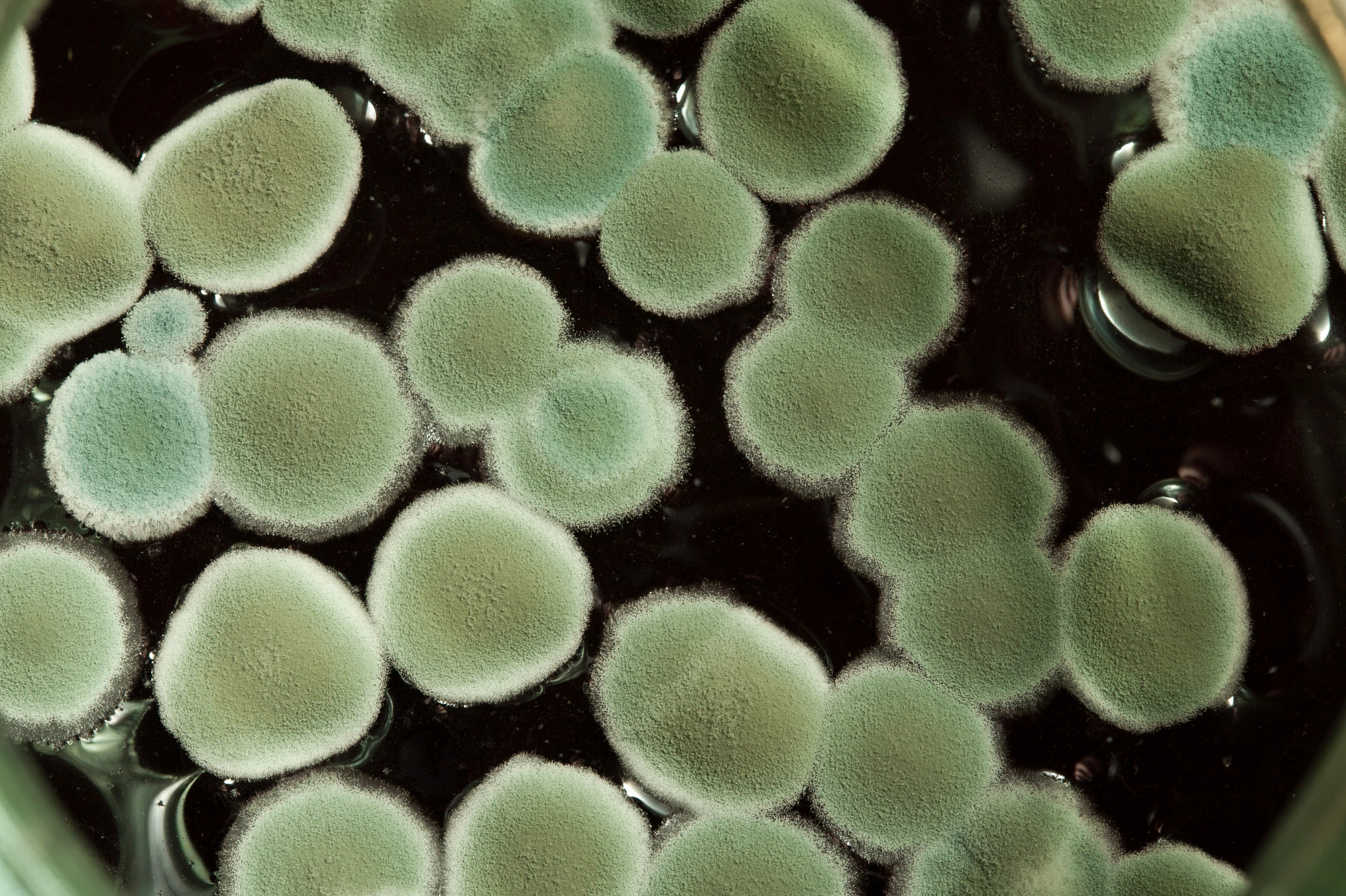 Urinary Tract Infection Bacteria Microscope