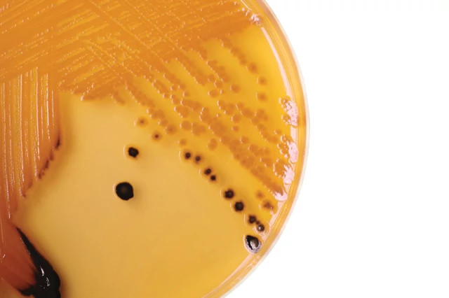 What Makes a Microbial Library Relevant for Identification? | Charles River